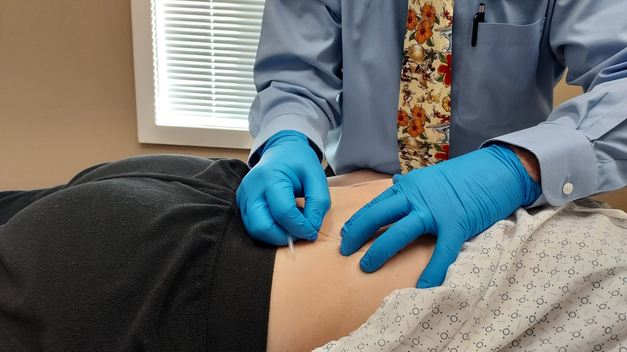 Dry Needling: A Tool Used by Physical Therapists to Treat Pain - Rehab ...